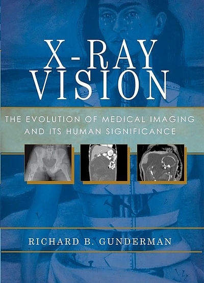 X-ray vision : the evolution of medical imaging and its human ...