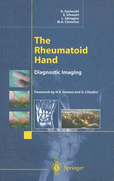 The rheumatoid hand : diagnostic imaging | WorldCat.org