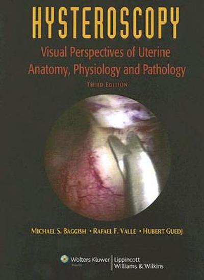 Hysteroscopy : visual perspectives of uterine anatomy, physiology, and ...