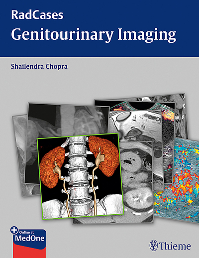 Radcases genitourinary imaging | WorldCat.org