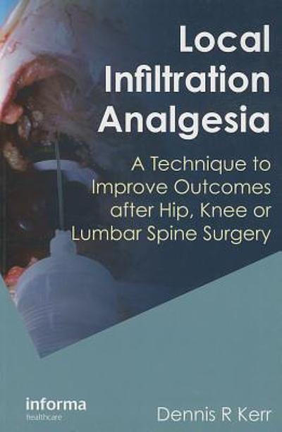 Local infiltration analgesia : a technique to improve outcomes after ...