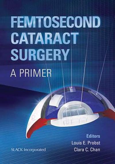 Femtosecond cataract surgery : a primer | WorldCat.org