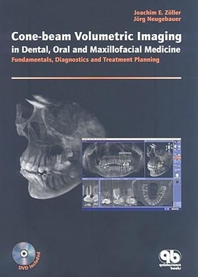 Cone-beam volumetric imaging in dental, oral and maxillofacial medicine ...