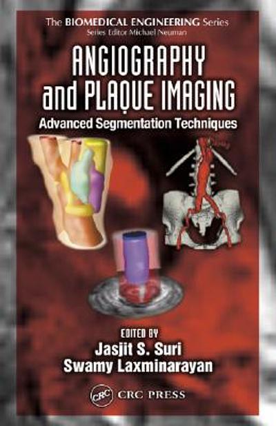 Angiography and plaque imaging : advanced segmentation techniques ... Angiography and plaque imaging : advanced segmentation techniques ...