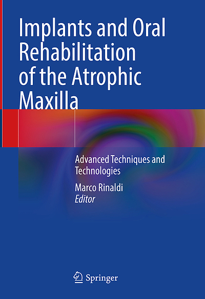 Implants and oral rehabilitation of the atrophic maxilla : advanced ...
