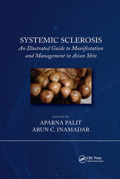 Systemic sclerosis : an illustrated guide to manifestation and ...