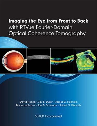 Imaging the eye from front to back with RTVue Fourier-domain optical ...