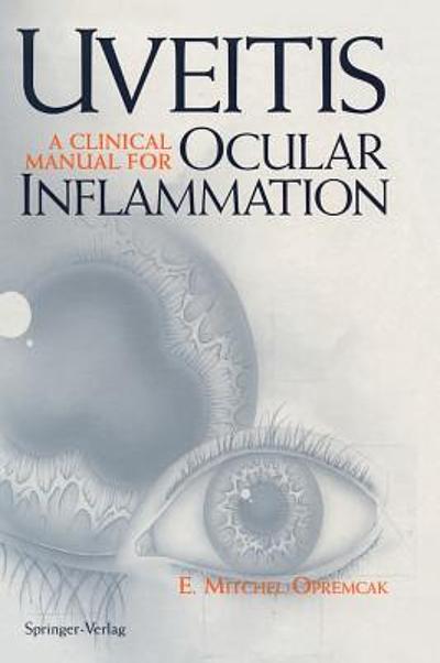 Uveitis : a clinical manual for ocular inflammation | WorldCat.org