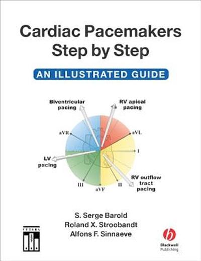 Cardiac pacemakers step by step : an illustrated guide | WorldCat.org