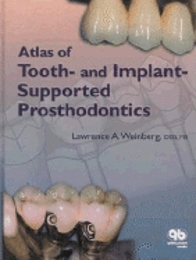 Atlas of tooth- and implant-supported prosthodontics | WorldCat.org