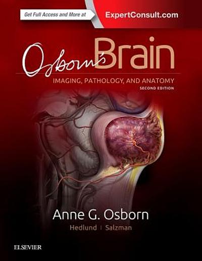 Osborn's brain : imaging, pathology, and anatomy | WorldCat.org