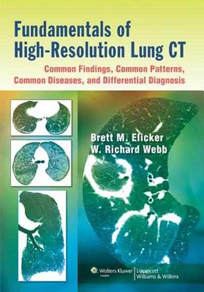 Fundamentals Of High Resolution Lung Ct Common Findings Common Patterns Common Diseases And