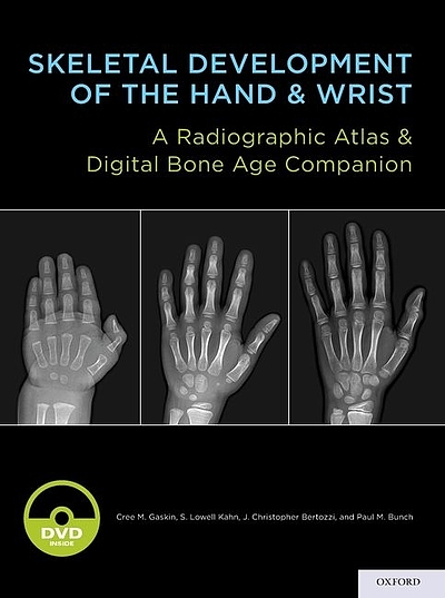 Skeletal development of the hand and wrist : a radiographic atlas and ...