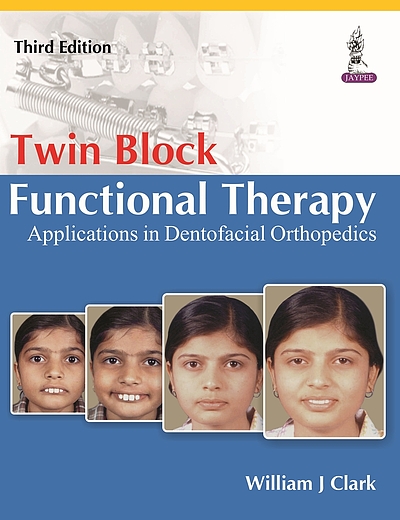 Twin block functional therapy: applications in dentofacial orthopaedics ...