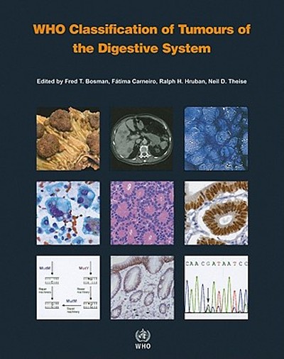 WHO classification of tumours of the digestive system | WorldCat.org