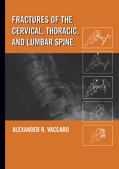Fractures of the cervical, thoracic, and lumbar spine | WorldCat.org