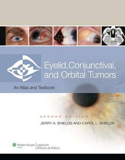Eyelid, conjunctival, and orbital tumors : atlas and textbook ...